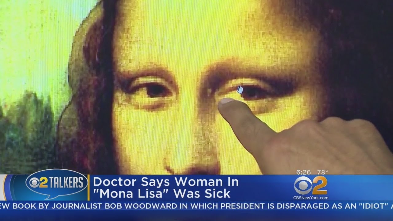 Doctor Claims 'Mona Lisa' Was Sick - YouTube