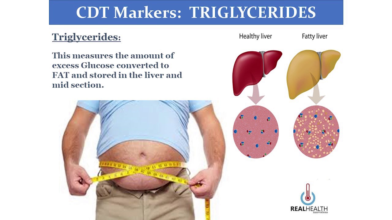 RHI CDT MARKERS - YouTube