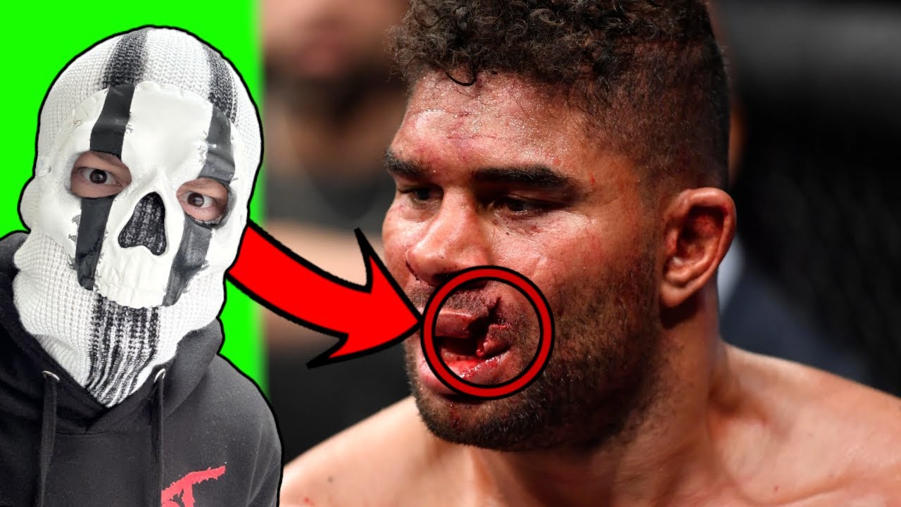 MOST GRUESOME FIGHT ENDING INJURIES! - YouTube