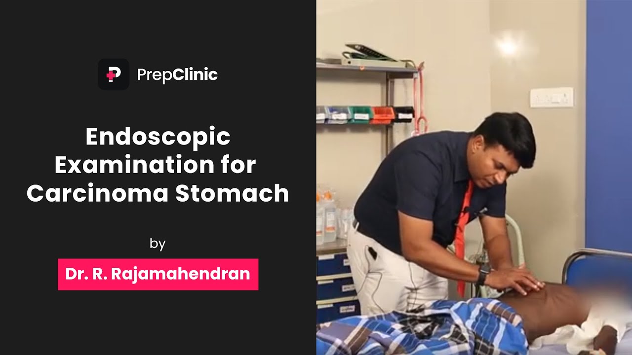 Endoscopic Examination for Carcinoma Stomach | Dr. R. Rajamahendran ...