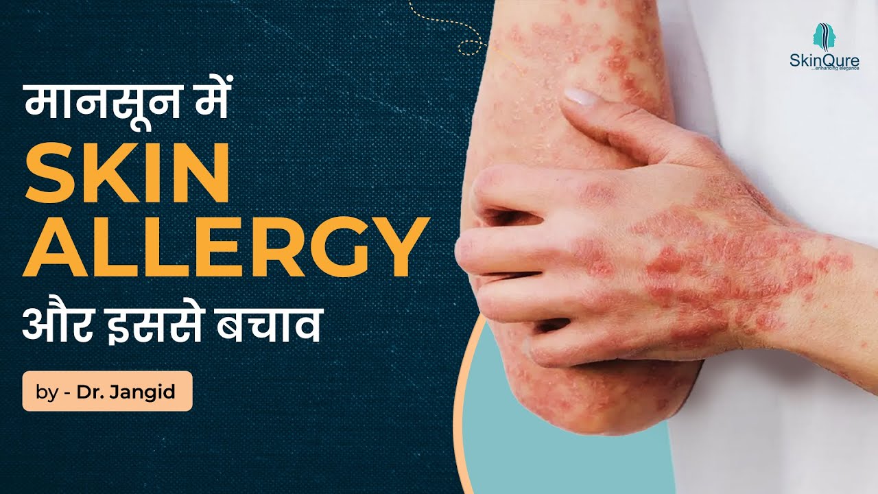 How to Treat Skin Allergies | Best Allergy Treatments for Sensitivity ...