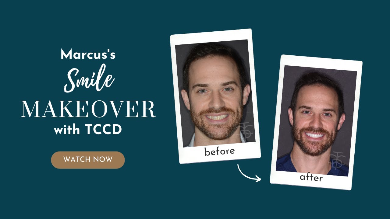 Step Up Your Smile Game with Top Cosmetic Dentist Dr. Guy Lewis - YouTube