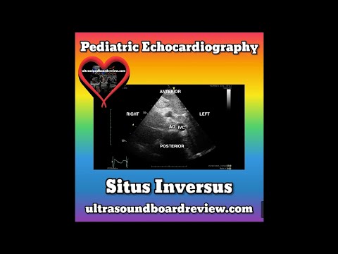 Situs Inversus