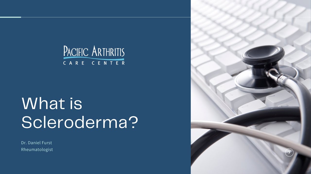 What is Scleroderma? - YouTube