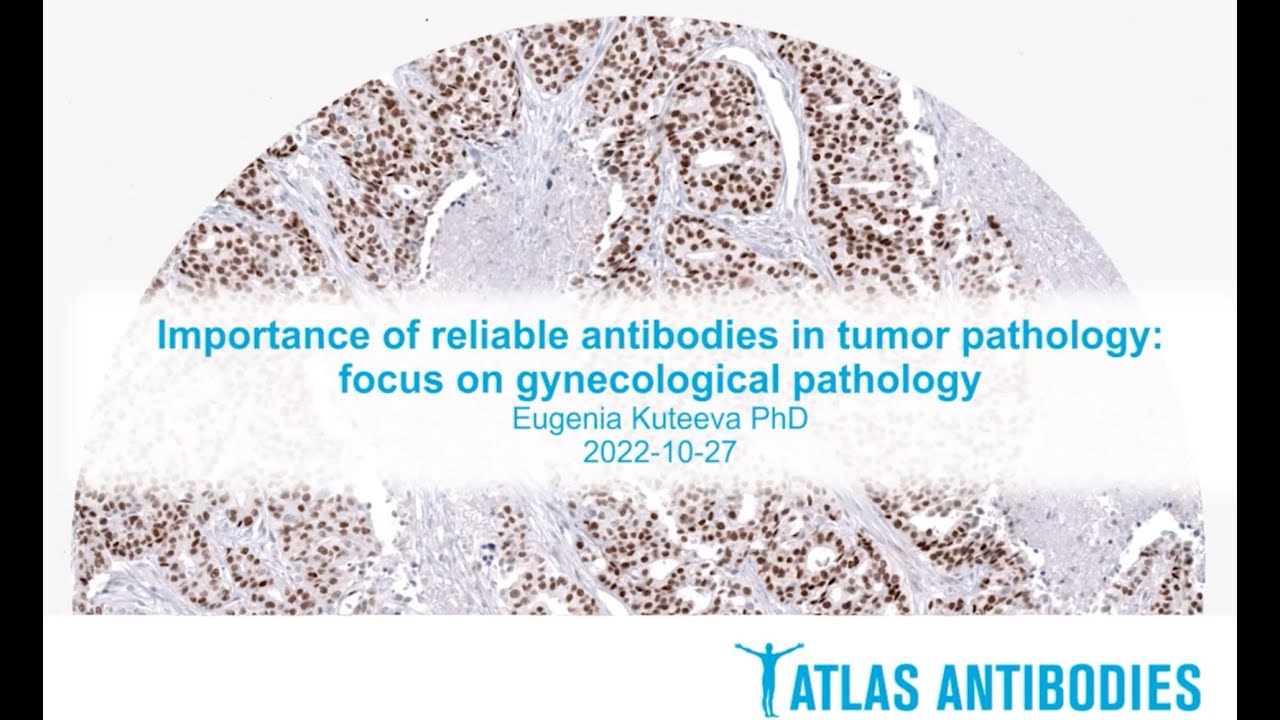 Webinar: Importance of reliable antibodies in tumor pathology, focus on ...
