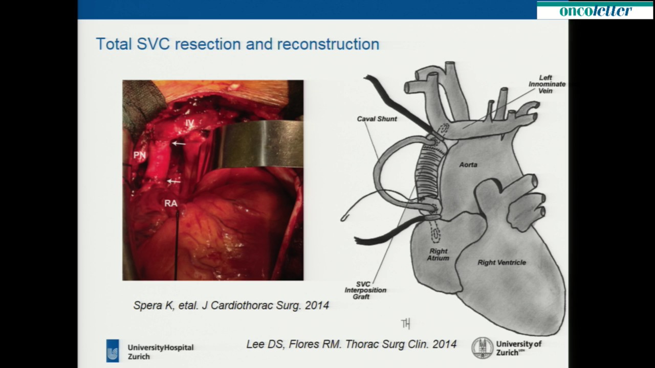 Isabelle Opitz, USZ - YouTube