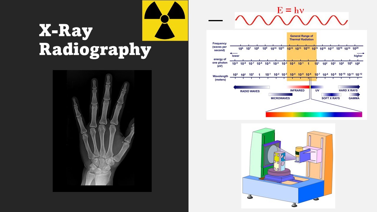 Practical Demonstration of X-ray Radiography NDT - YouTube
