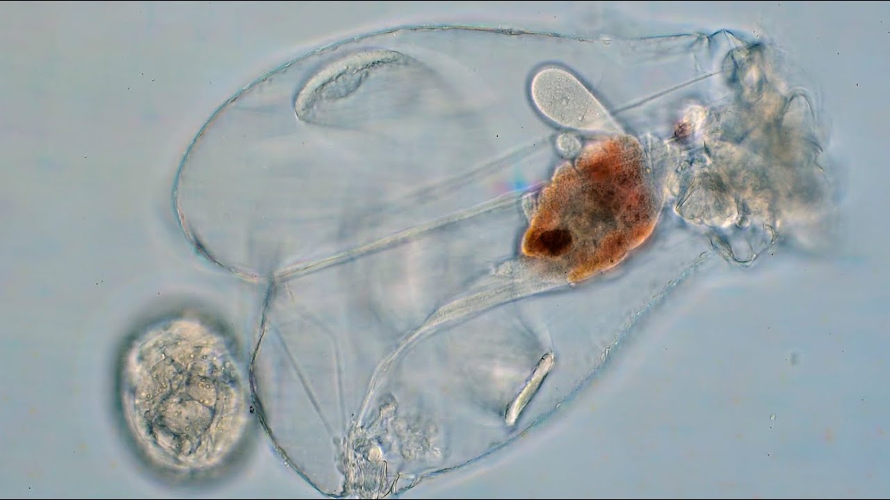 Rotifer - Epiphanes sp - YouTube