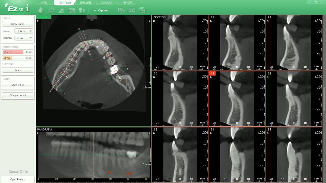 Ez3D i Demo V1 1 4 - YouTube