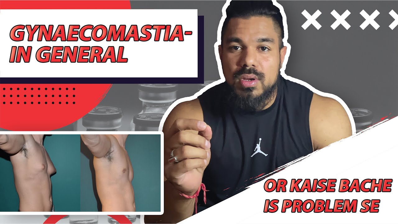 GYNAECOMASTIA KYA HAI | BODYBUILDERS KAISE BACHE GYNO SE| ALL ABOUT ...