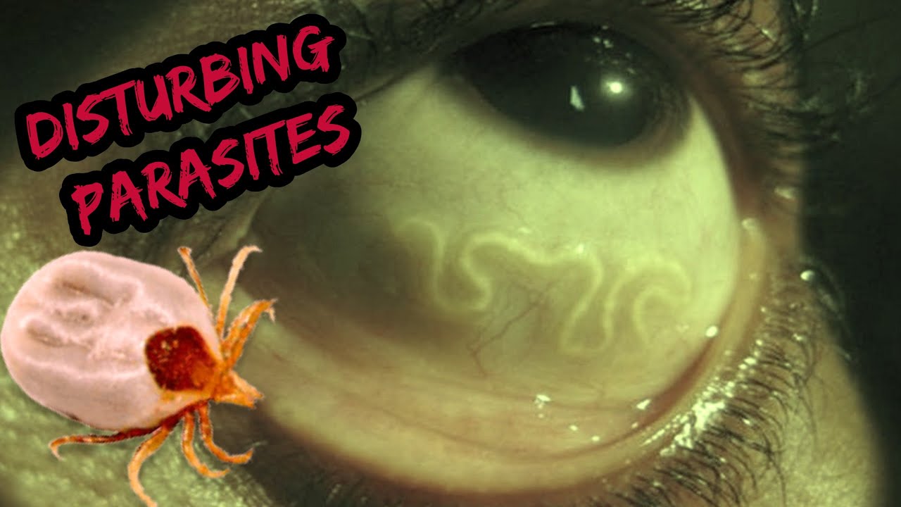 8 Disturbing Types Of Parasites - YouTube