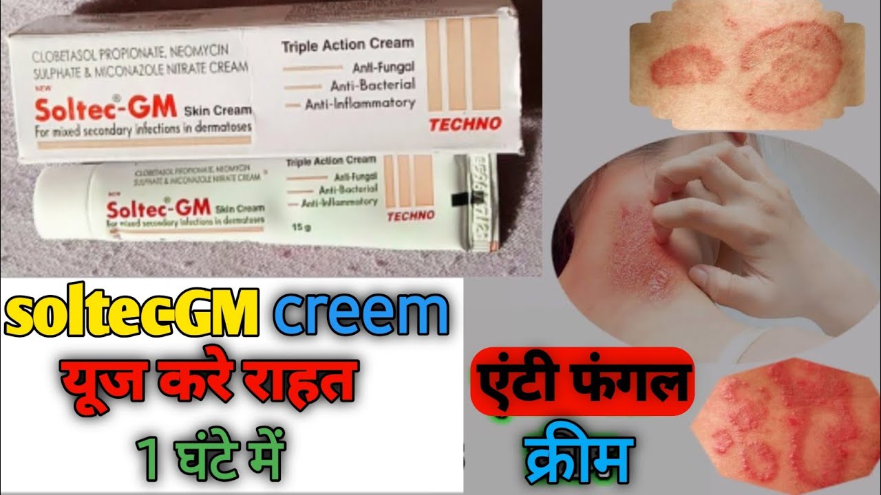 soltec-GM skin CREAM clobetasol propionate,miconazole nitrate and ...