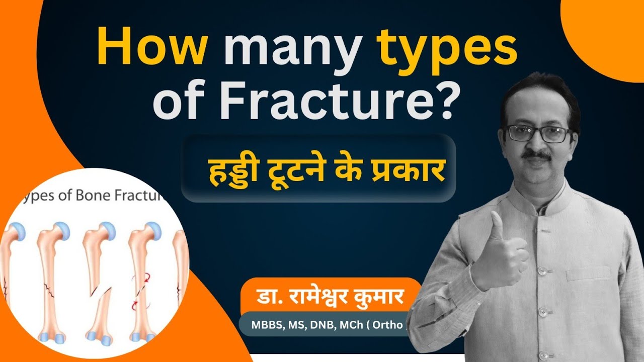 Common types of Bone fracture | Types of Fracture | How many types of ...