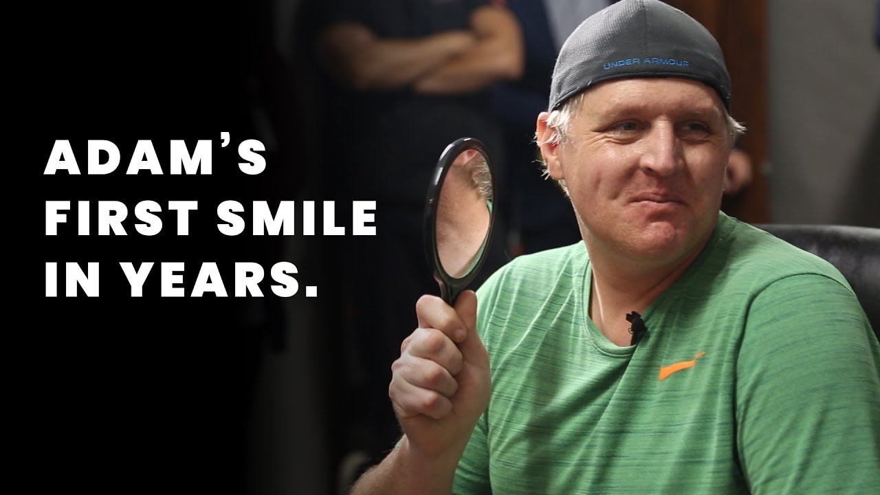 Watch Adam smile for the first time in years! | All-on-4® Dental ...