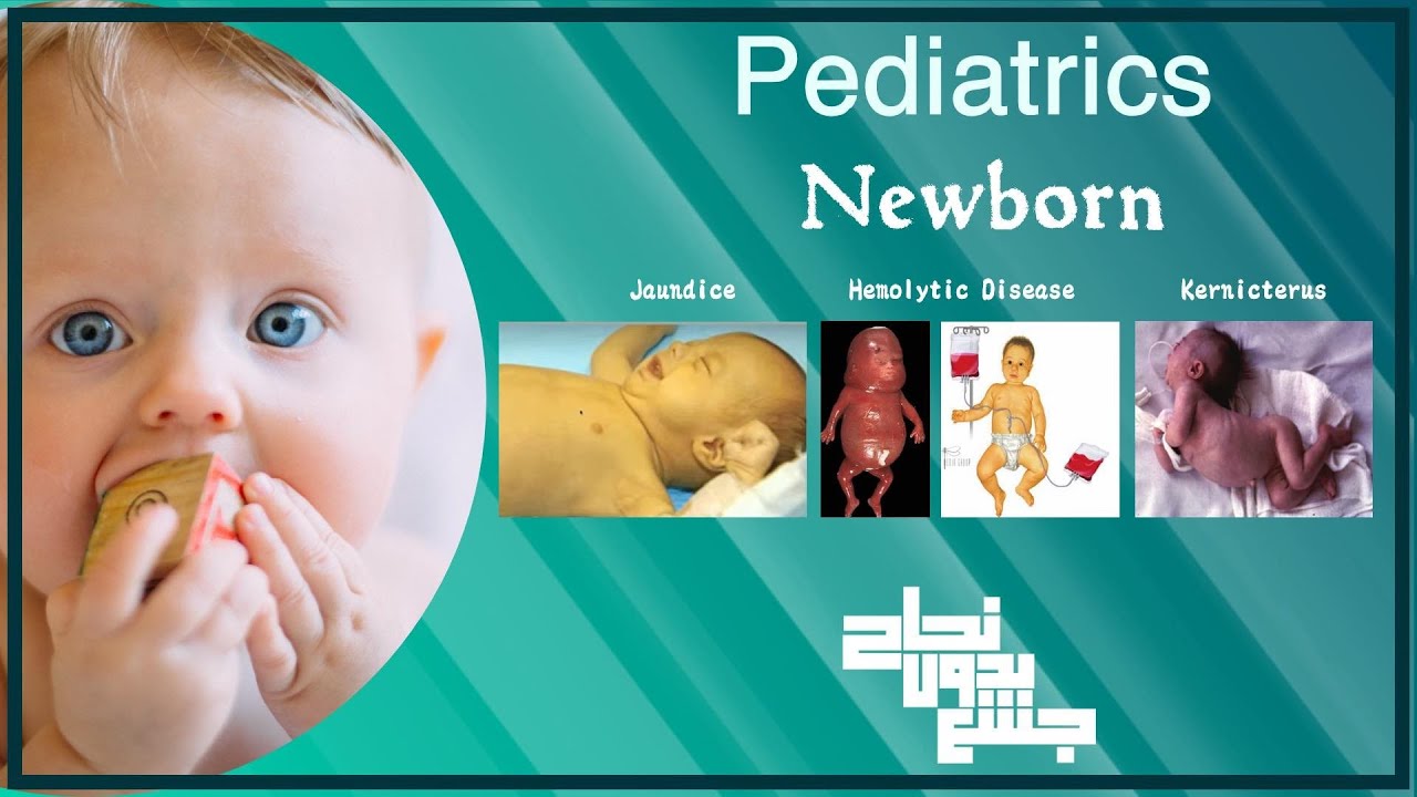Ch1 part 4, Newborn (Jaundice) , Pediatrics - YouTube