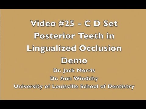 Video #25 - C D Set Up Posterior Teeth in Lingualized Occlusion Demo ...