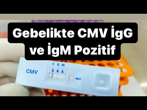 Gebelikte CMV İgG ve İgM Pozitif Ne Demektir?