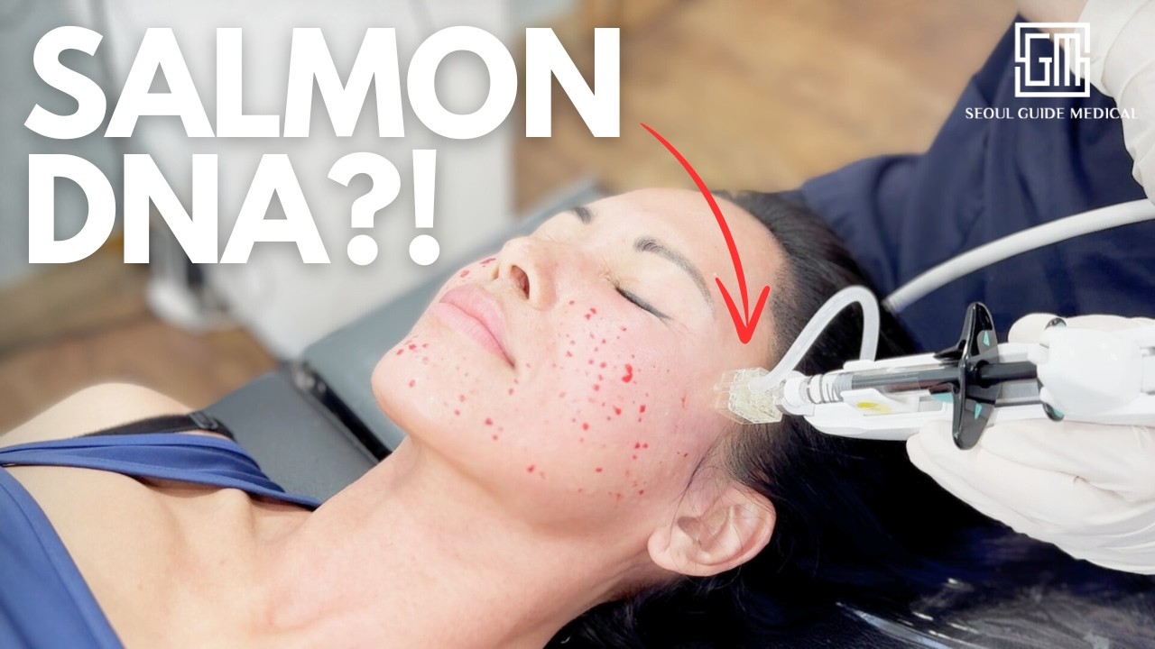 I tried the Famous Salmon Sp**m DNA Skin Booster (Rejuran) in Korea ...