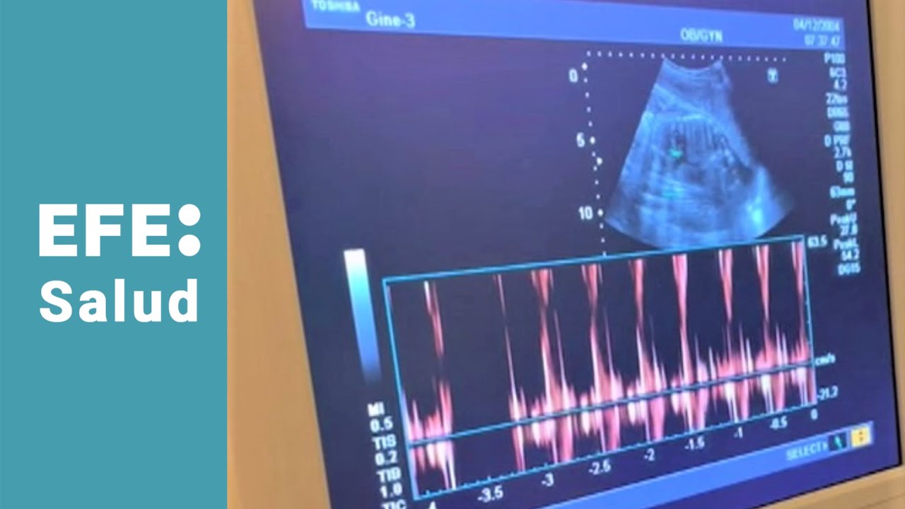 La valía del latido fetal embrionario - YouTube