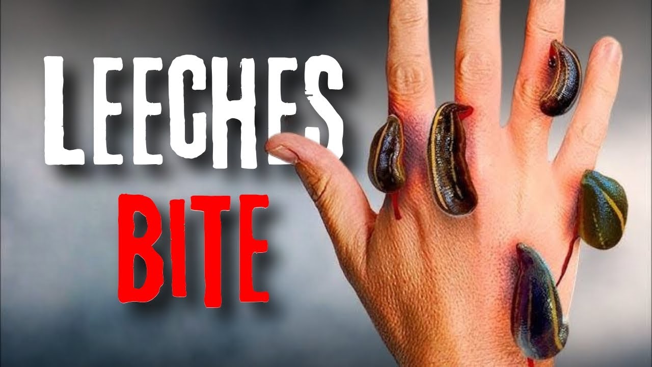 How Do Leeches Bite - YouTube