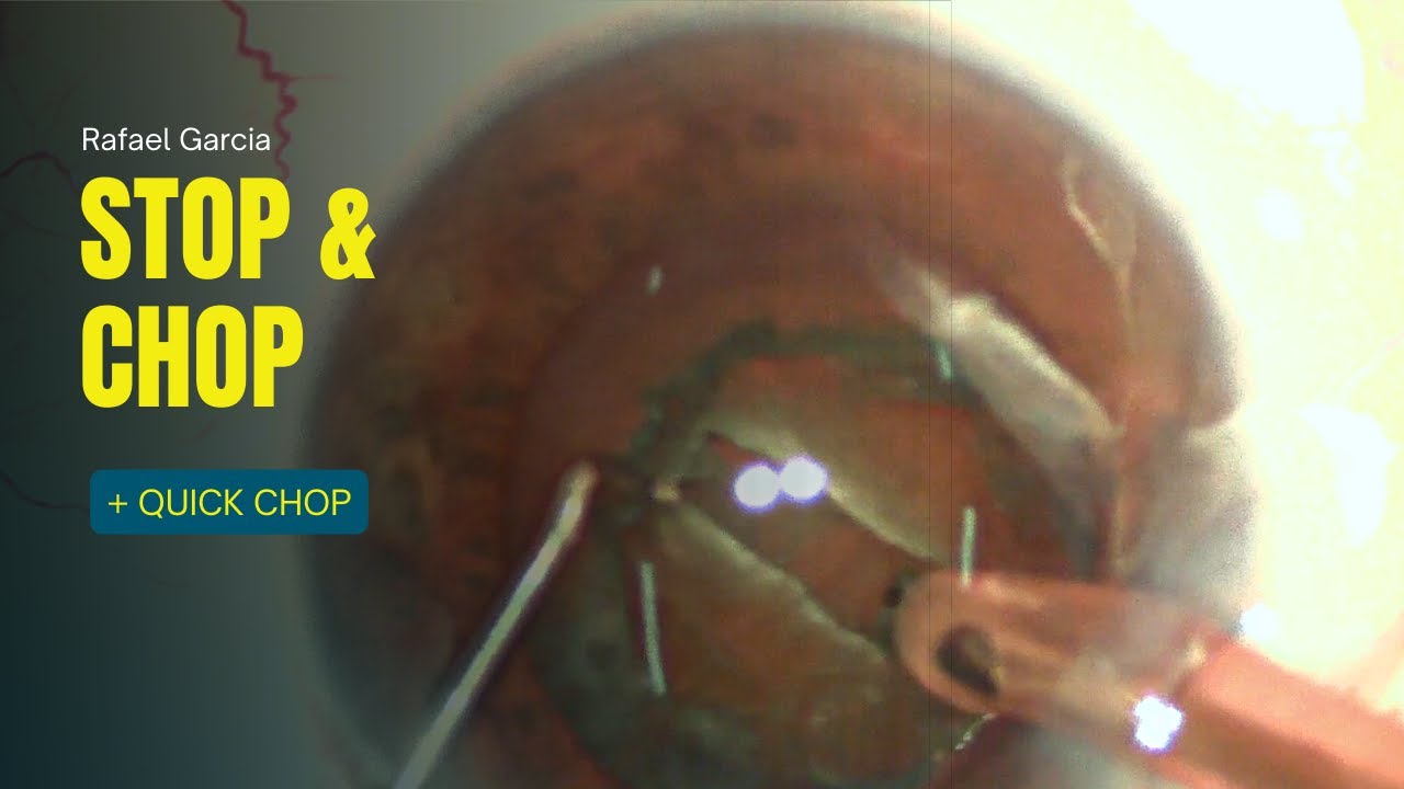 Stop and chop + Quick chop - YouTube