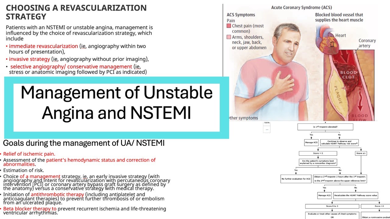 Management of Unstable Angina/ NSTEMI - YouTube