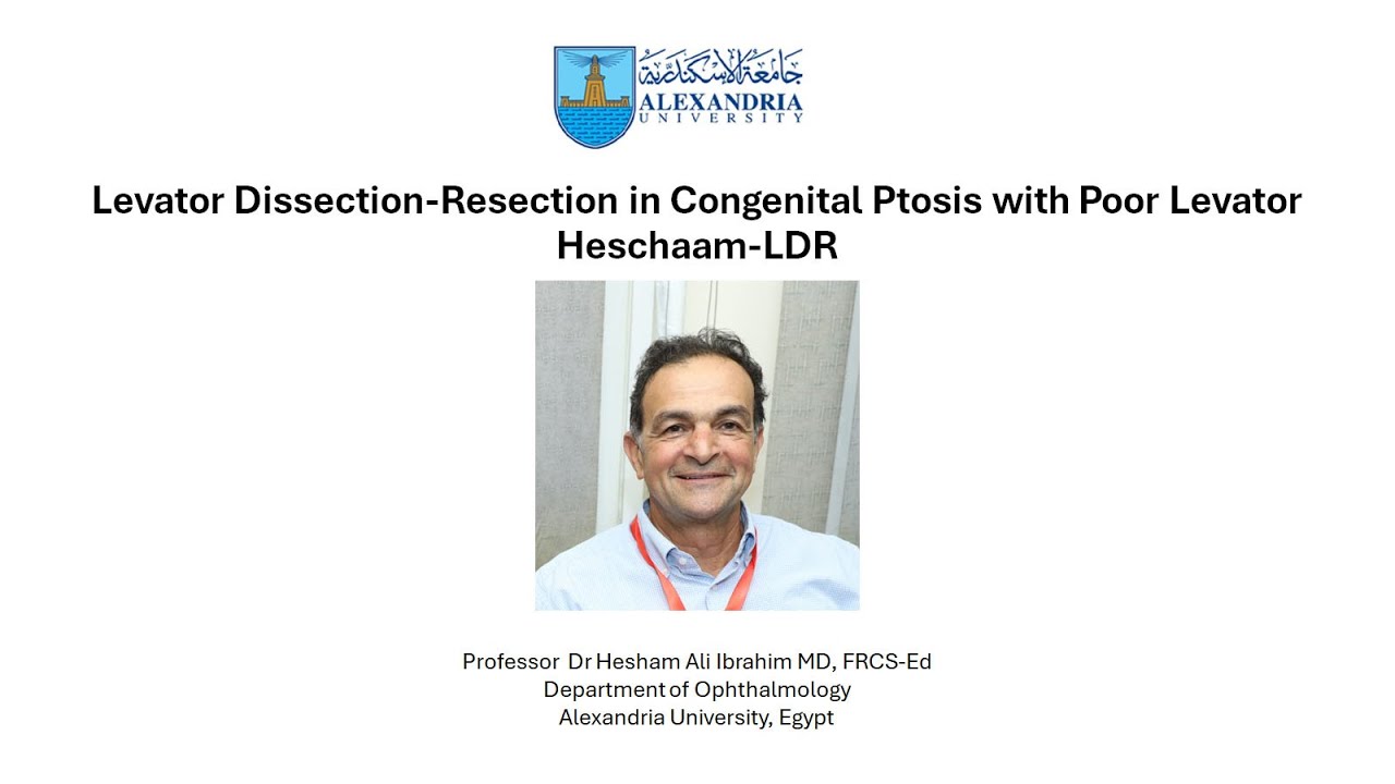 Levator Dissection Resection for ptosis with poor levator function (H ...