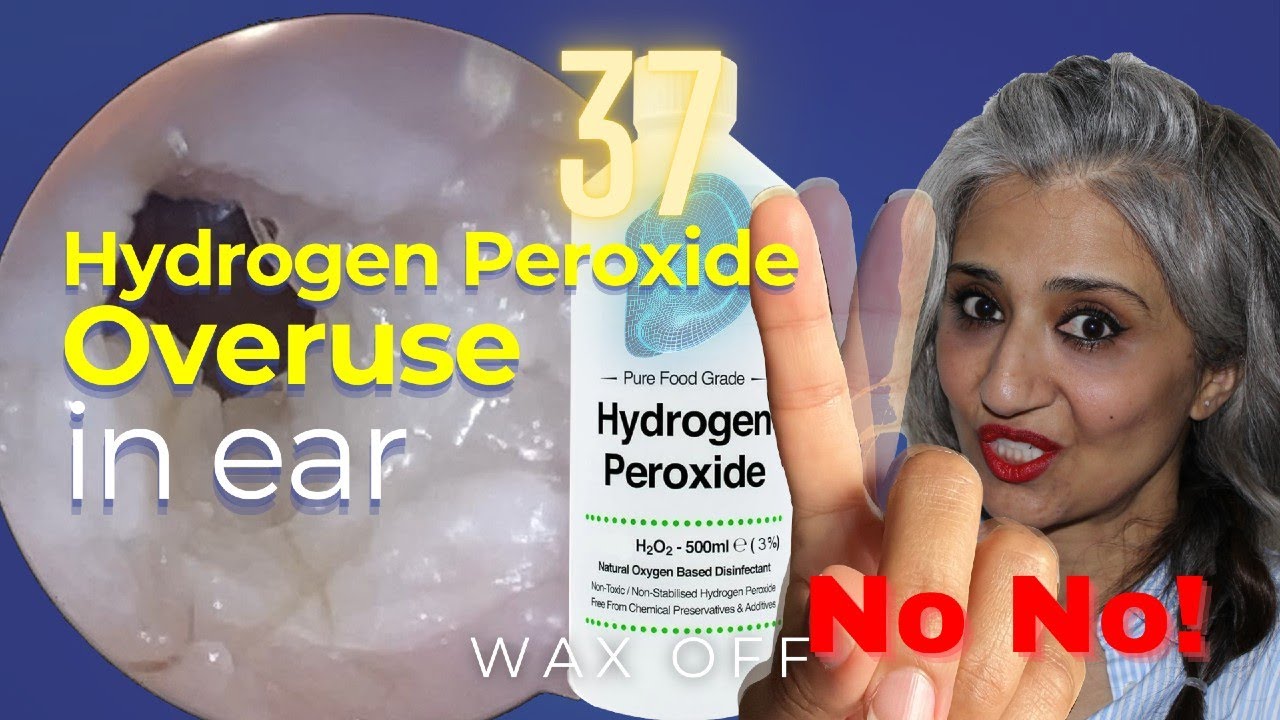Hydrogen Peroxide Overuse In Ear | Wax Off Episode 37 - YouTube