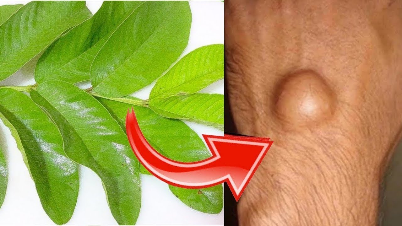 Toute les boules,grosseurs,dans le corps, petite ou grosse, fondront ...