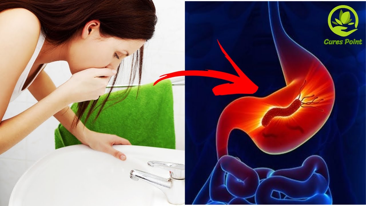 How to Cure H.Pylori Naturally at Home | Herbal Treatment For H-Pylori ...