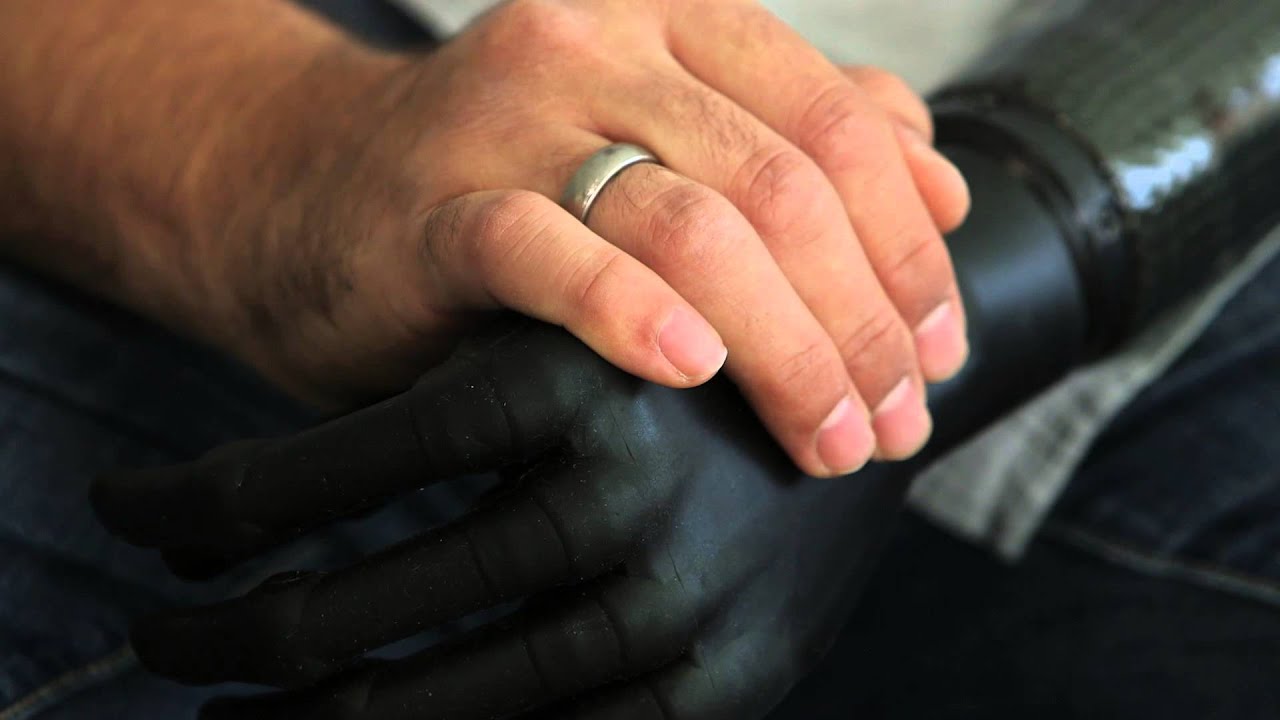 Conal Doyle Discusses Representing Amputees | Doyle Law - YouTube