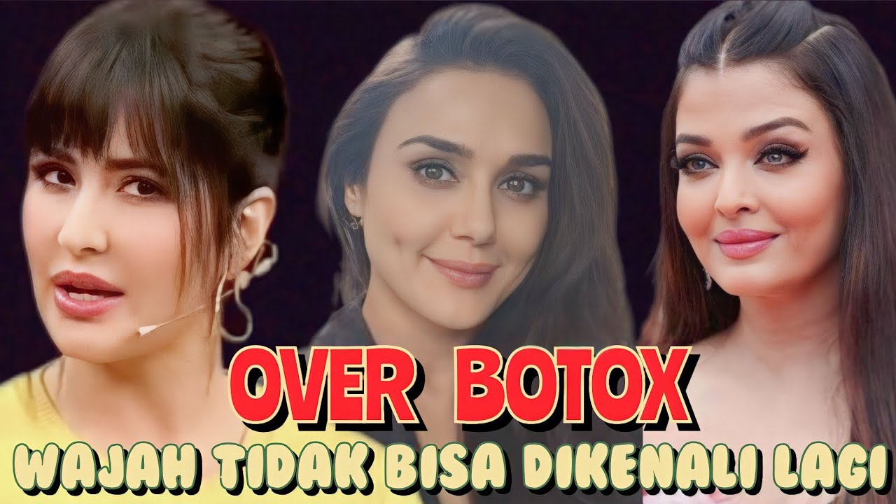 KELEBIHAN BOTOX, WAJAH 7 ARTIS INDIA INI BERUBAH LAIN - YouTube
