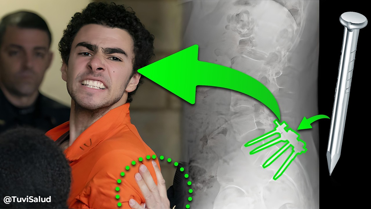 💀 La HORRIBLE VERDAD detrás del dolor de LUIGI MANGIONE 💥 - YouTube