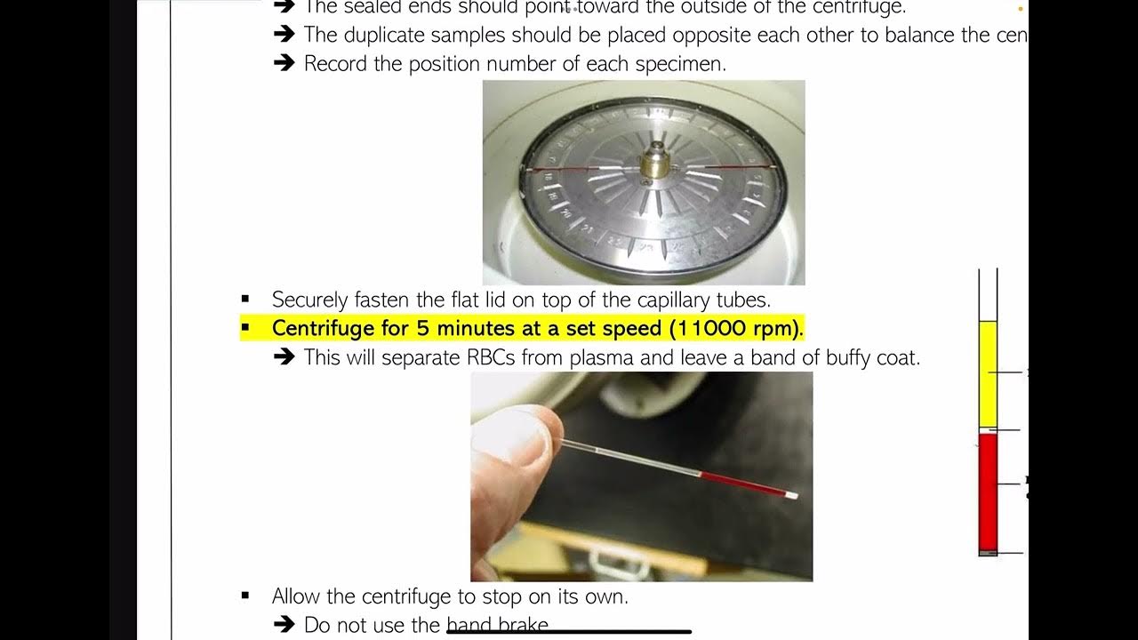 Physiology lab3 part 1 - YouTube