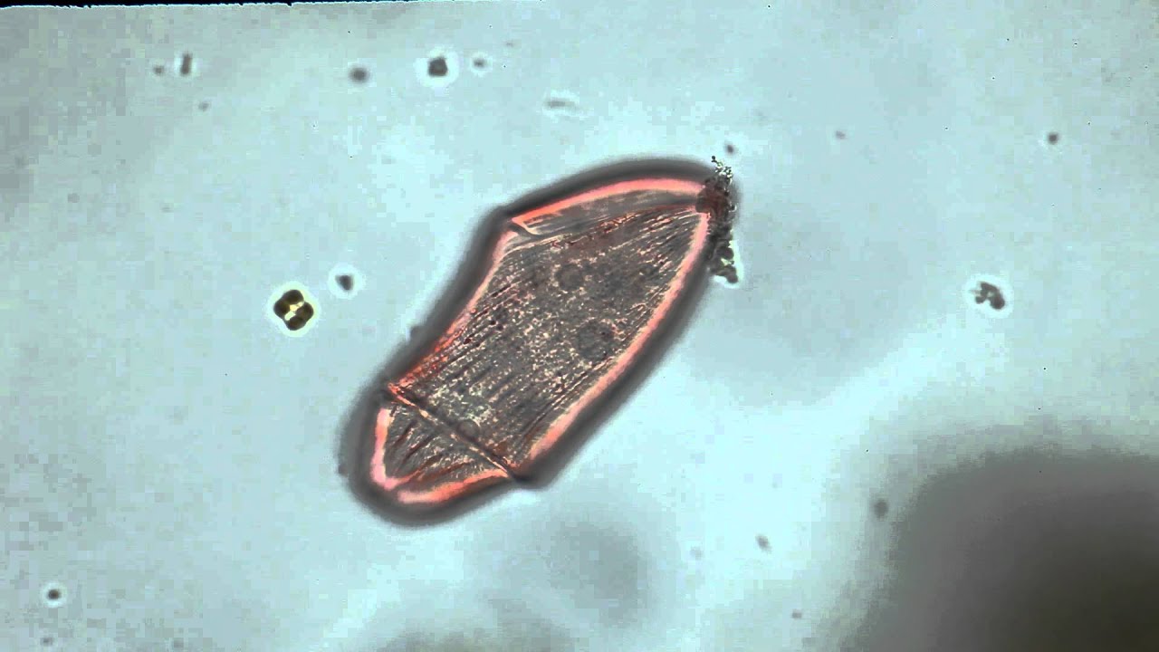 Gyrodinium sp. - YouTube