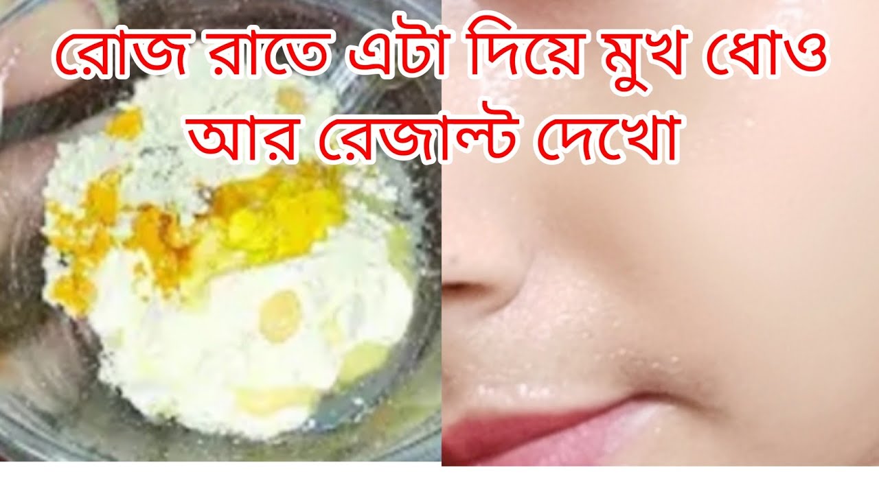 রোজ রাতে এটা দিয়ে মুখ ধোও আর রেজাল্ট দেখো/kalo dag tolar upay/forsa ...