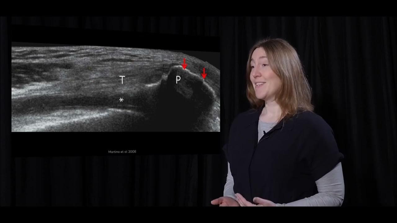 Introduction to MSK Ultrasound - Anatomical Tissues part 4 - YouTube