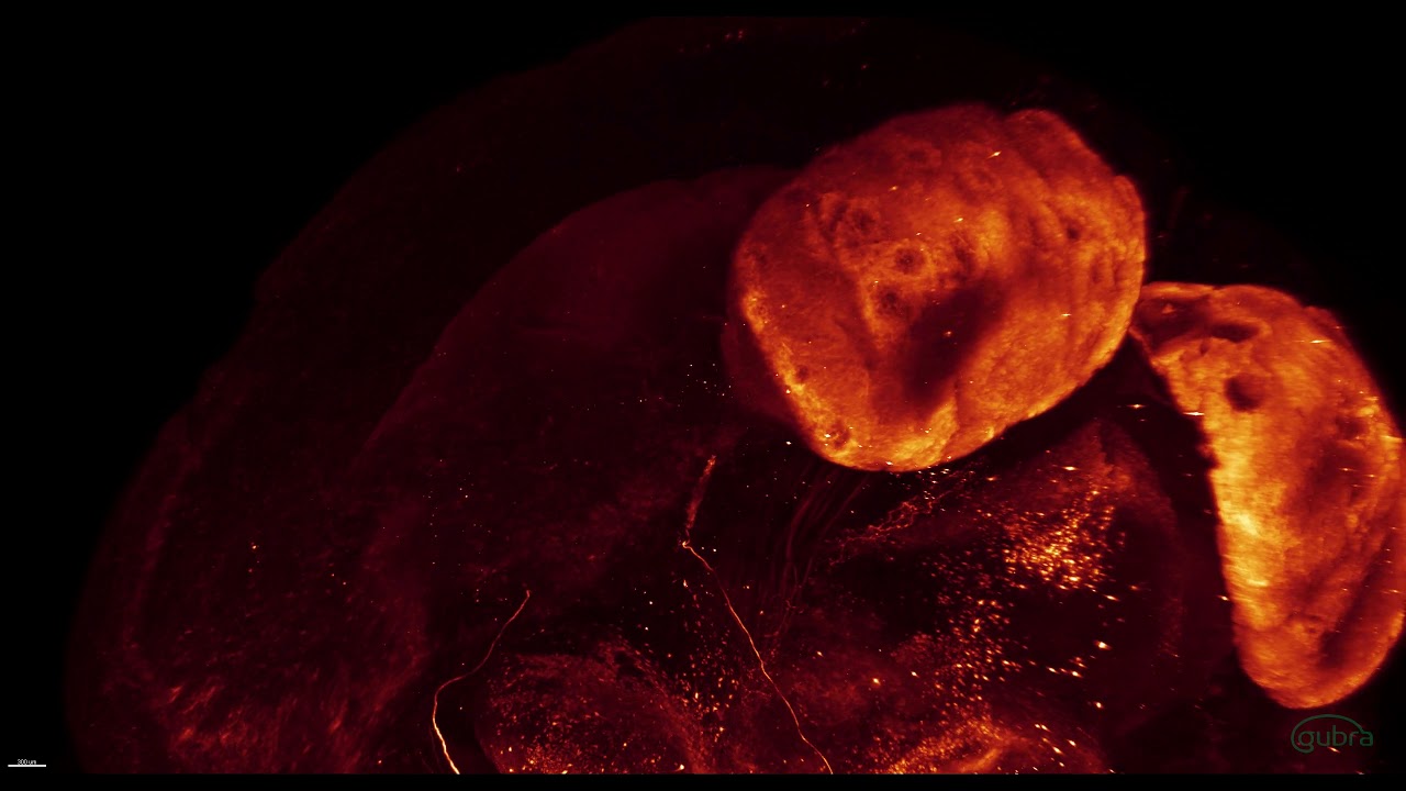 Light sheet microscopy of TH positive neurons in an adult mouse brain ...