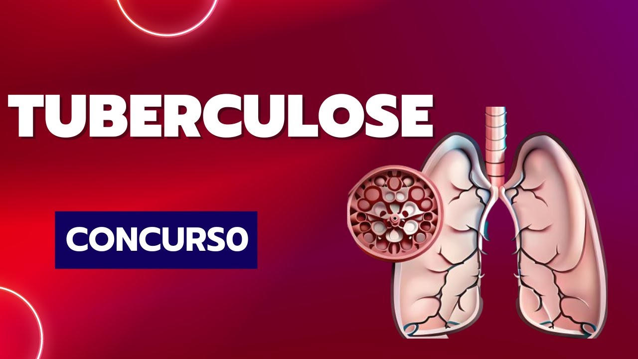 [TUDO SOBRE TUBERCULOSE]: Transmissão, Sintomas, Prevenção - YouTube
