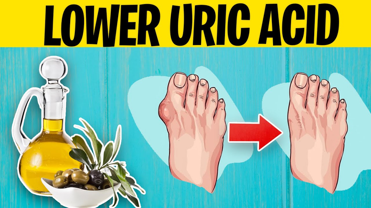 How To Lower Uric Acid Naturally And Prevent Gout Youtube