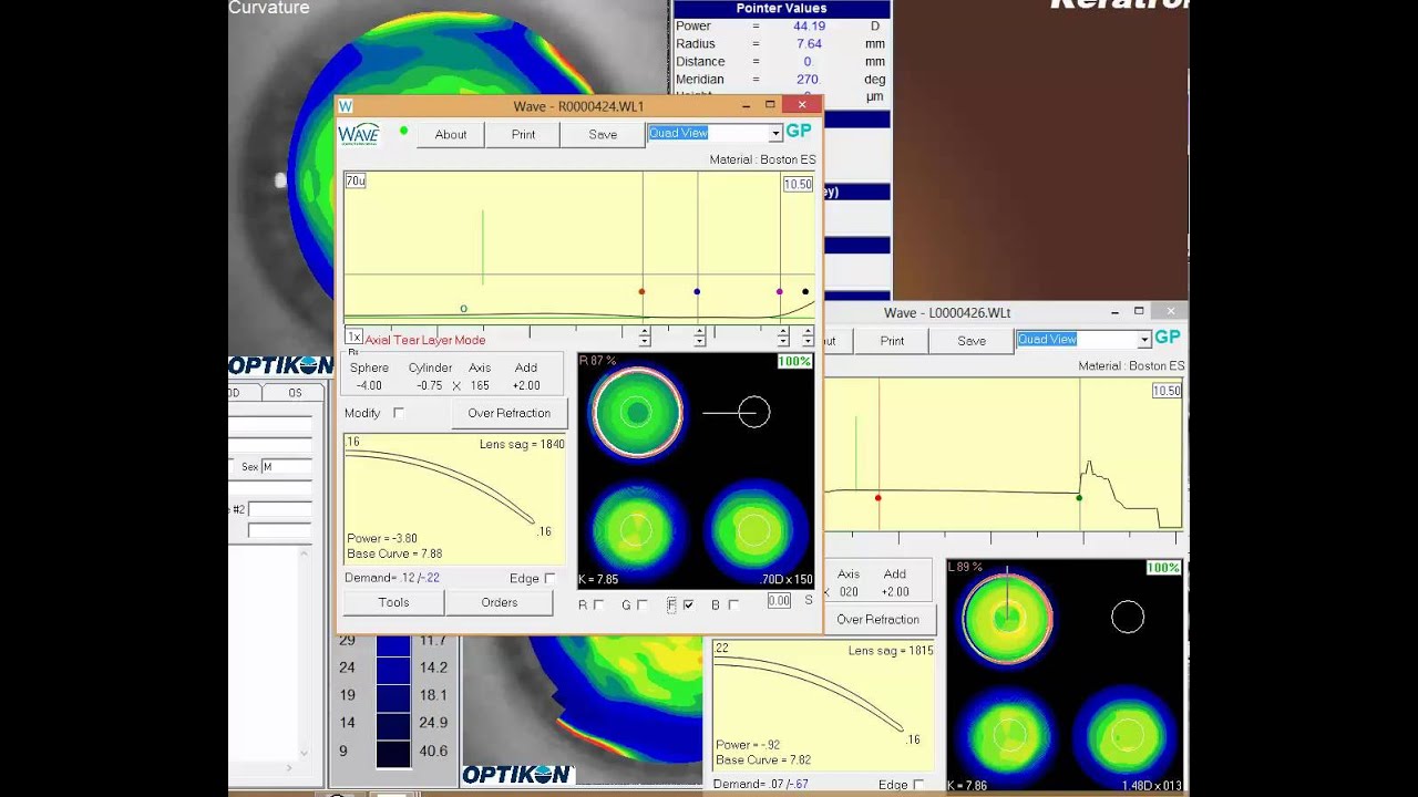 Legacy WAVE - new multifocal RGP - YouTube