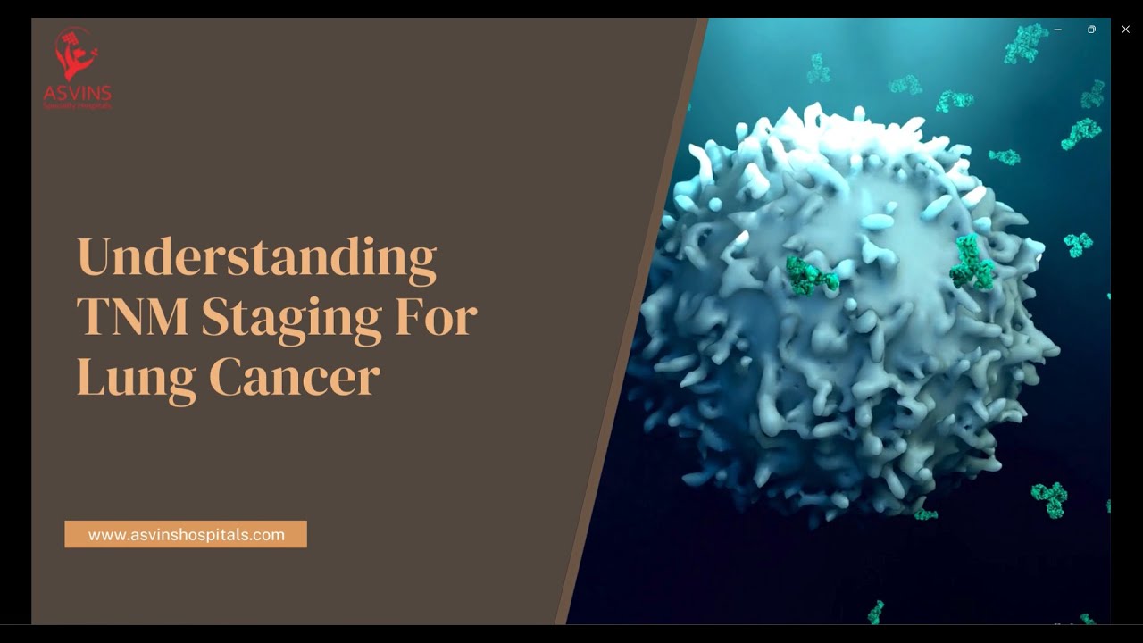 Understanding TNM Staging For Lung Cancer - YouTube