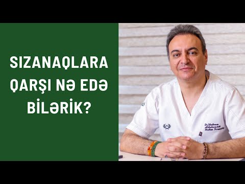 Sızanaqlara qarşı nə edə bilərik❓
