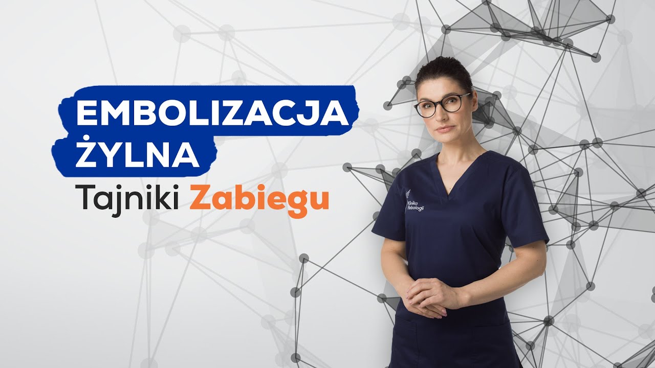 Embolizacja Żylna: 💡przełom💡w leczeniu Chorób Żył! - YouTube