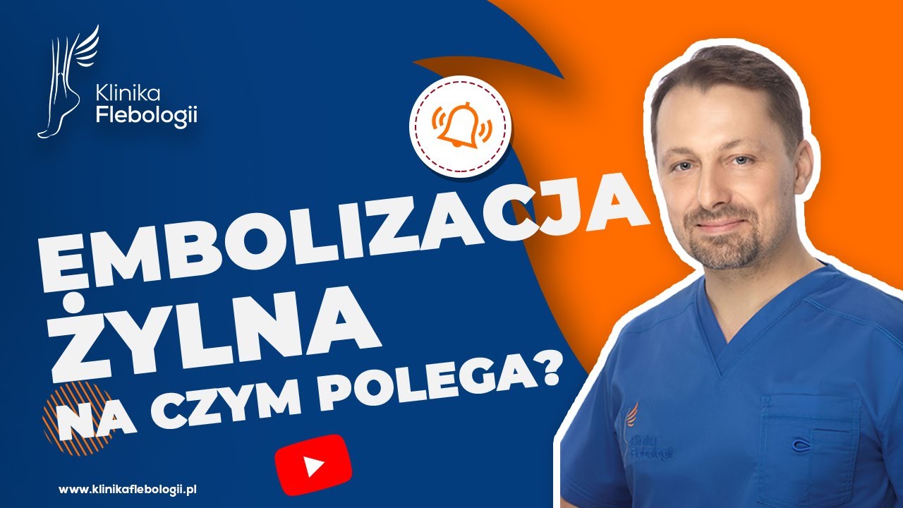 Embolizacja żylna - na czym polega? - YouTube