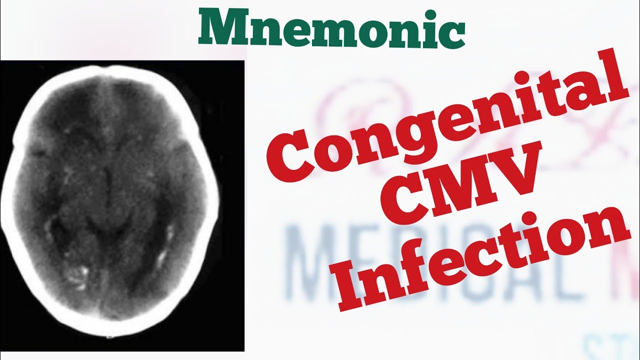 Congenital Cmv