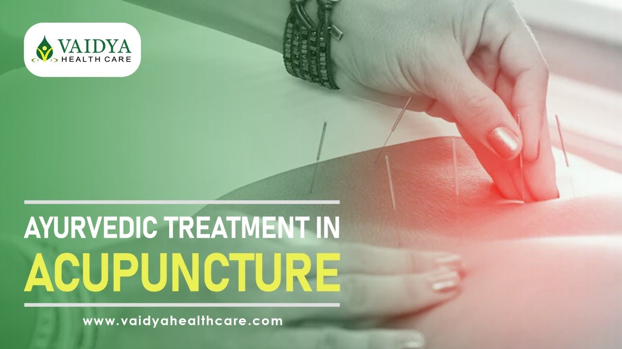 Ayurvedic treatment in acupuncture explained by Dr. Anu Alias | Vaidya Healthcare, Kochi, Kerala ...