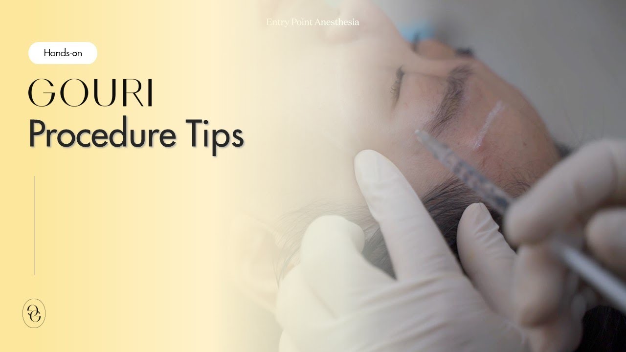 [official] GOURI cannula procedure tips - from anestesia to GOURI ...