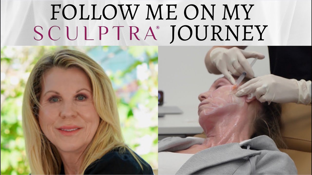 Follow Me as I Try Sculptra For the 1st Time at 59 yrs old! Fountain of ...