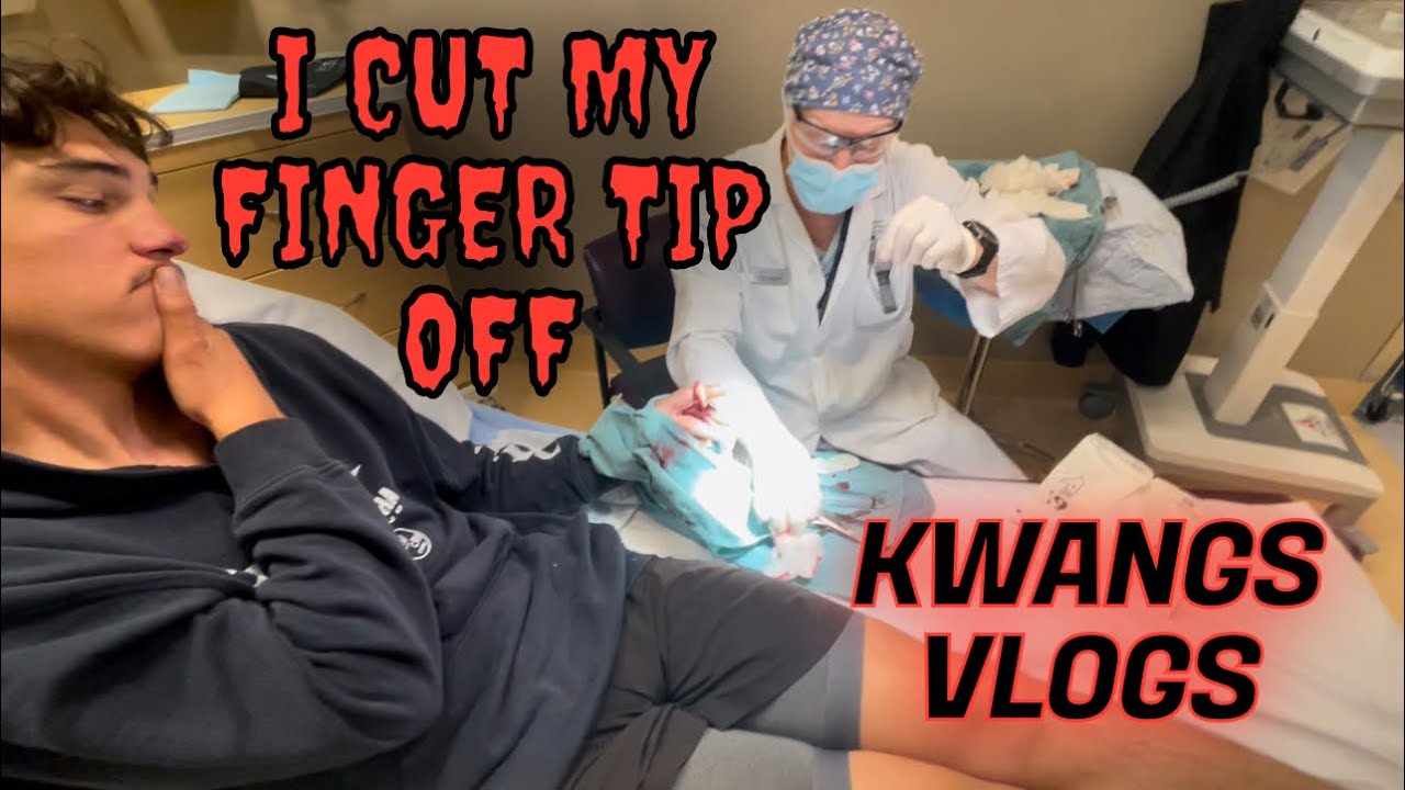 I LOST MY FINGER TIP MID RACE!! KWANGS VLOGS - YouTube